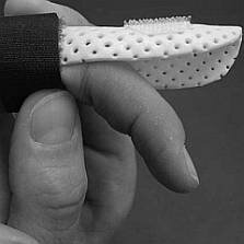 Vingers: gewrichten, arthrose en breuken | NKBV